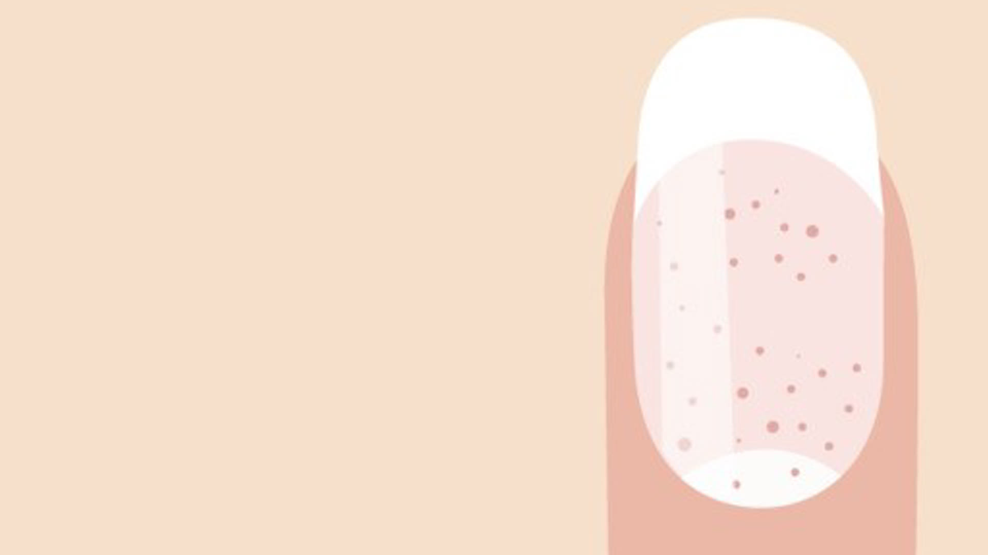Watch Things Your Nails Can Tell You About Your Health | SELF