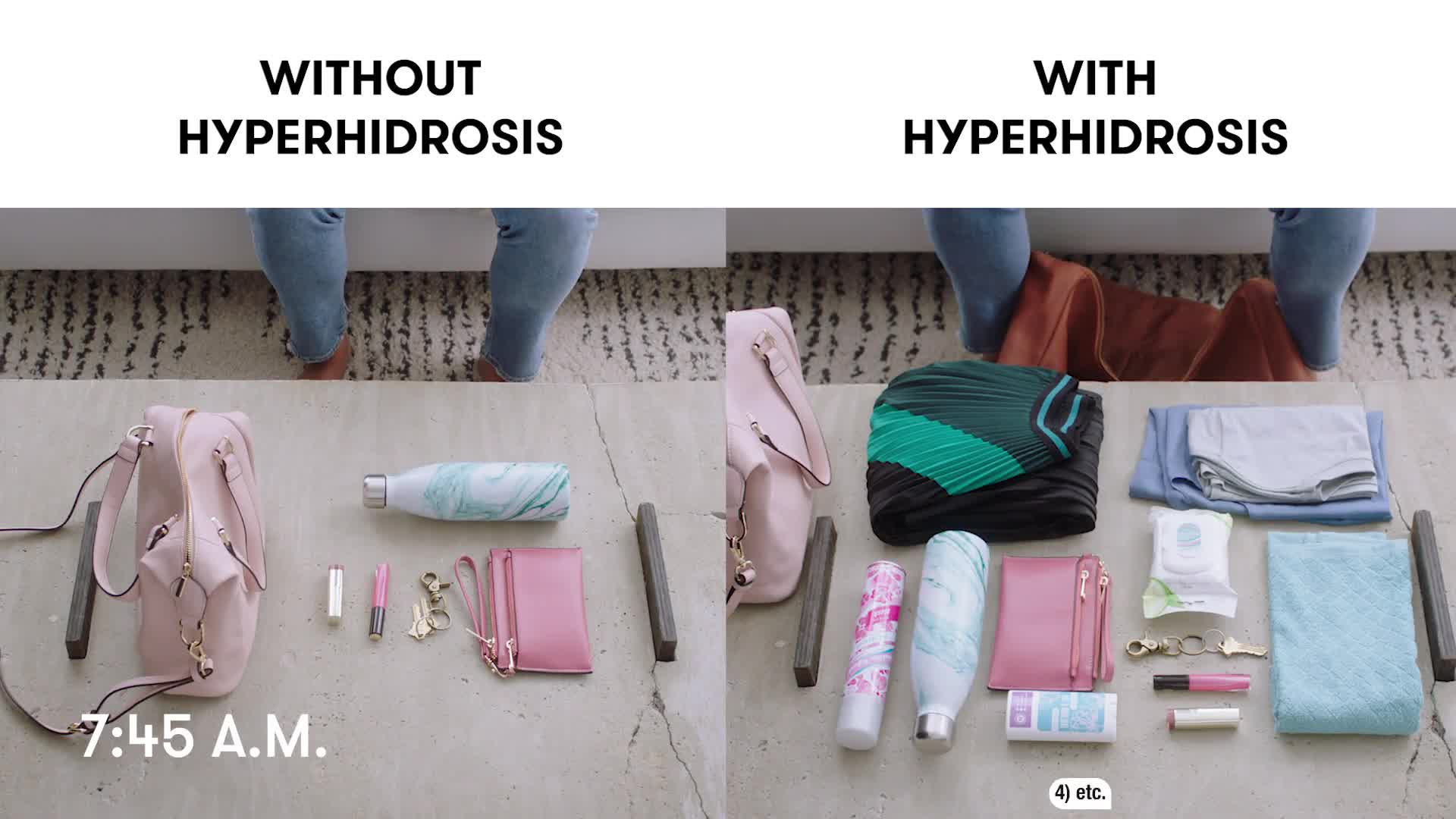 Watch This Is What It's Really Like to Live With Hyperhidrosis | SELF