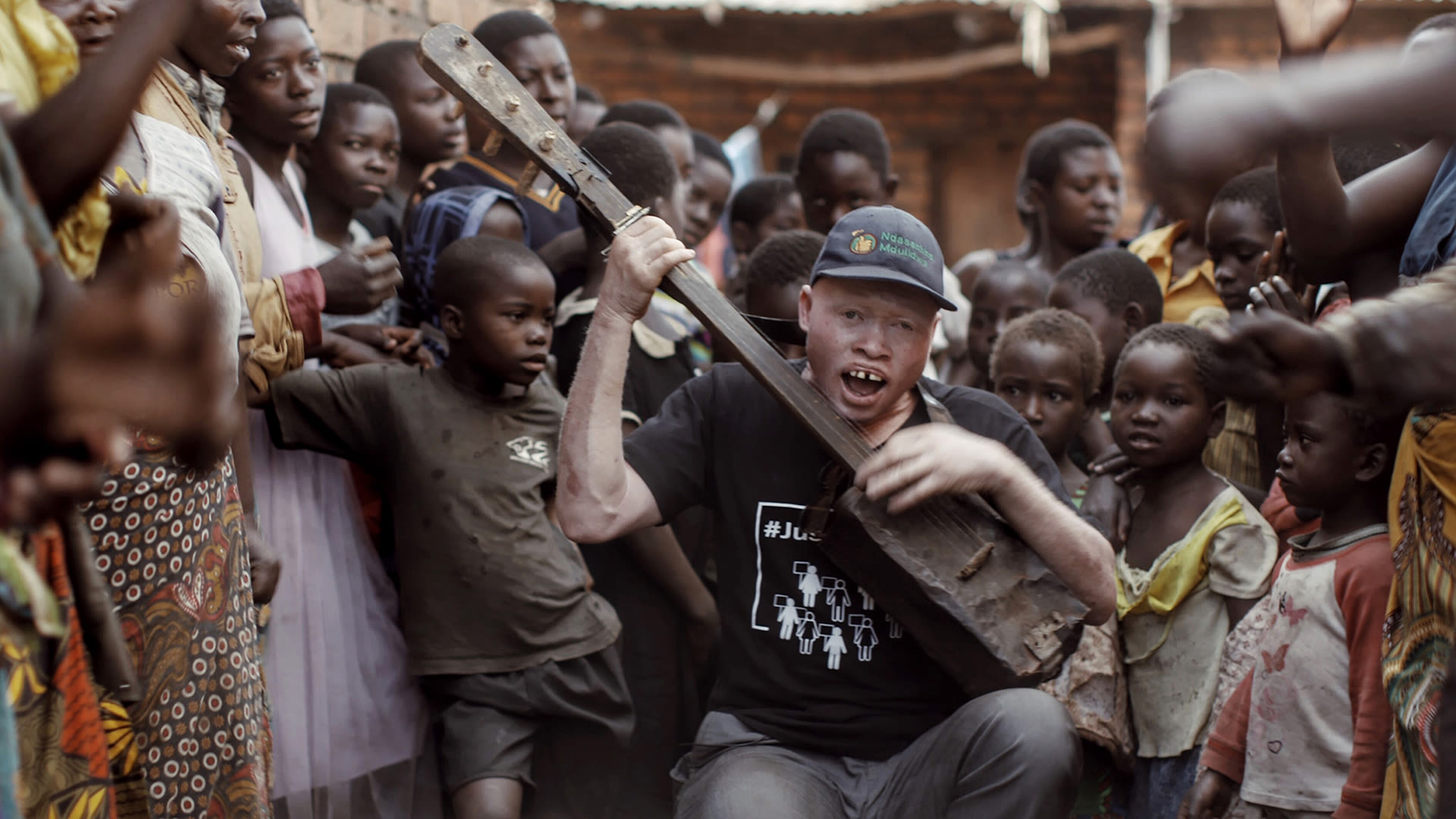Watch A Street Musician Fights the Stigma of Albinism in Africa | The ...