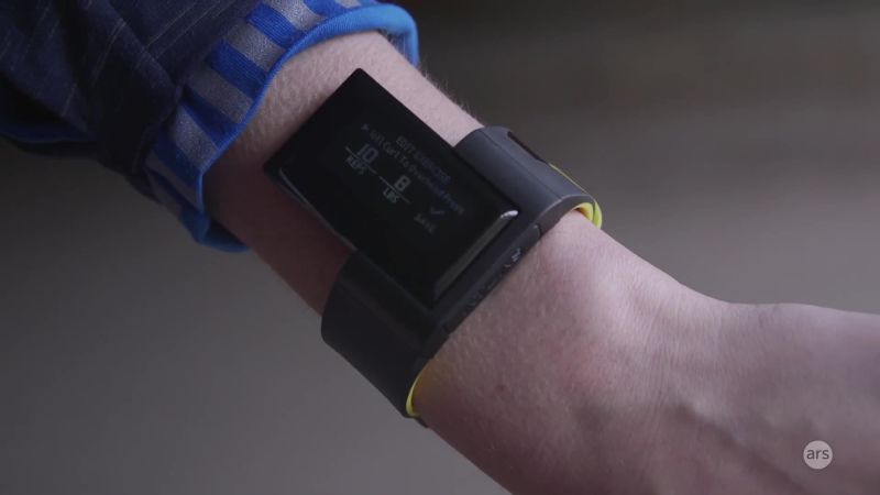 Watch Tech | Ars reviews the Atlas Wristband | Ars Technica Video | CNE