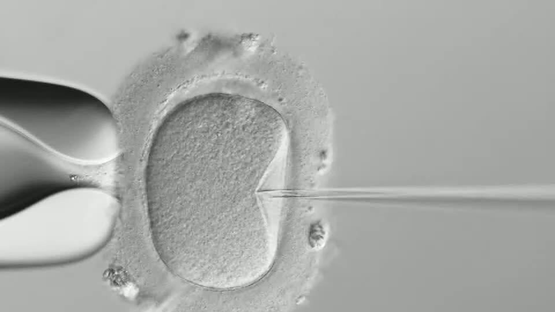 Watch Tecnica ICSI (Courtesy of IVI) | Vogue Italia