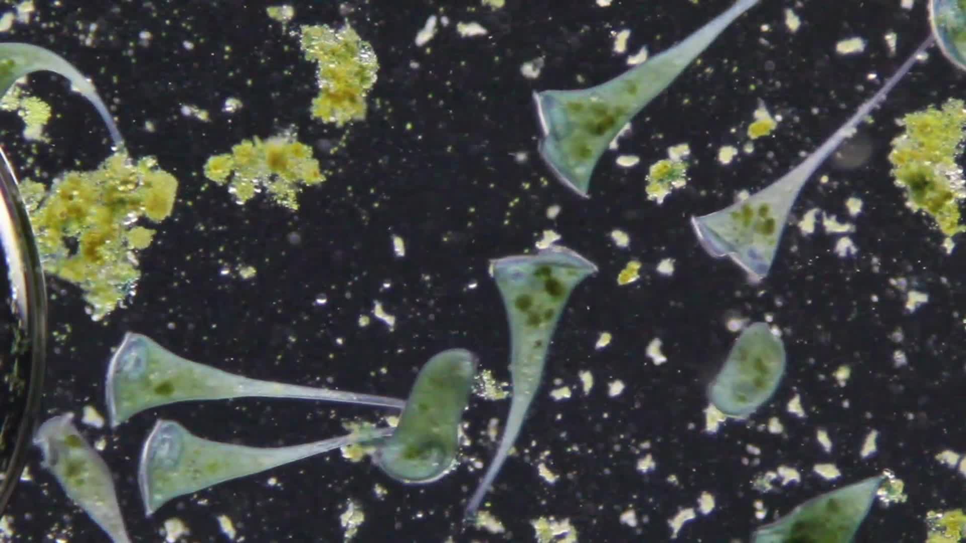 Watch The Single-Celled Stentor Could Hold the Secret to Human ...