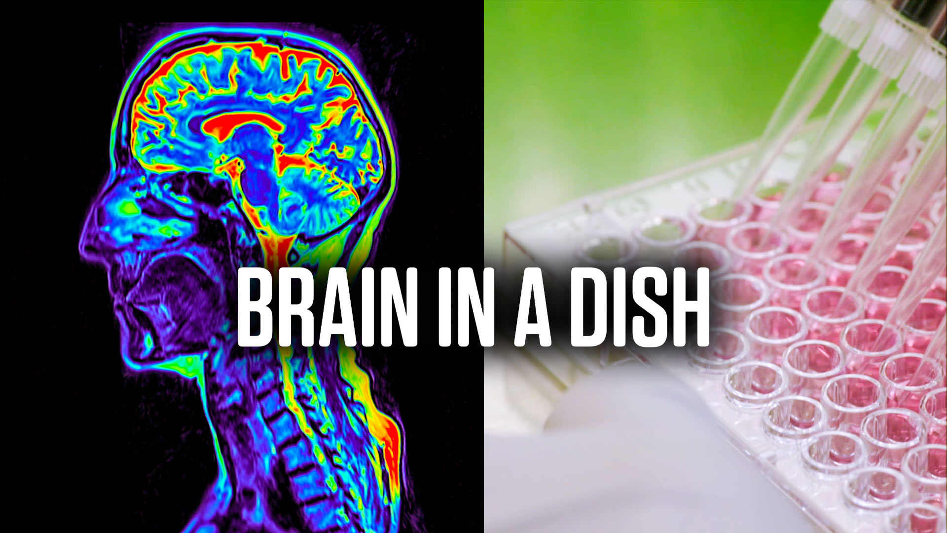 Watch How Brain Organoids Help Scientists Battle Disease | WIRED Brand ...