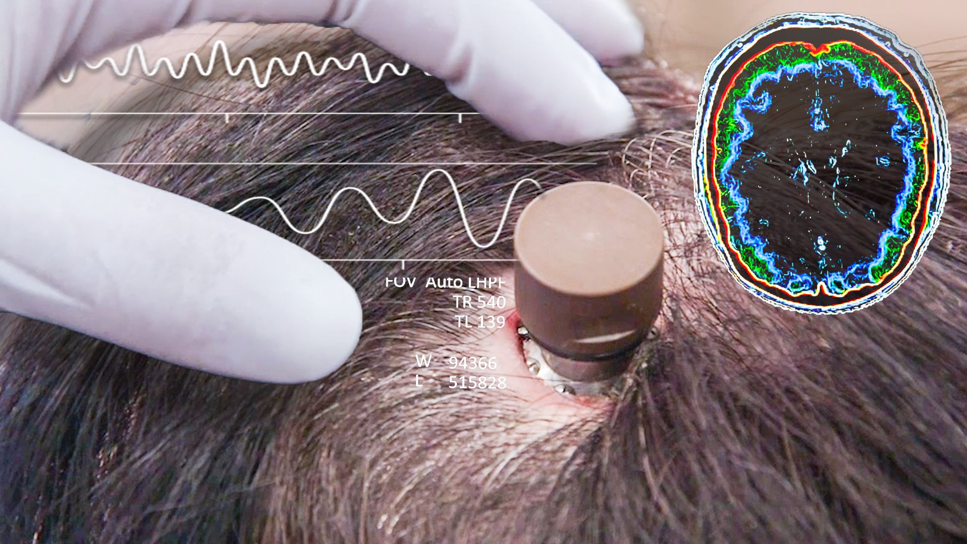 Watch The Science Behind Elon Musk s Neuralink Brain Chip Currents Watch The Science Behind Elon Musk s Neuralink Brain Chip Currents