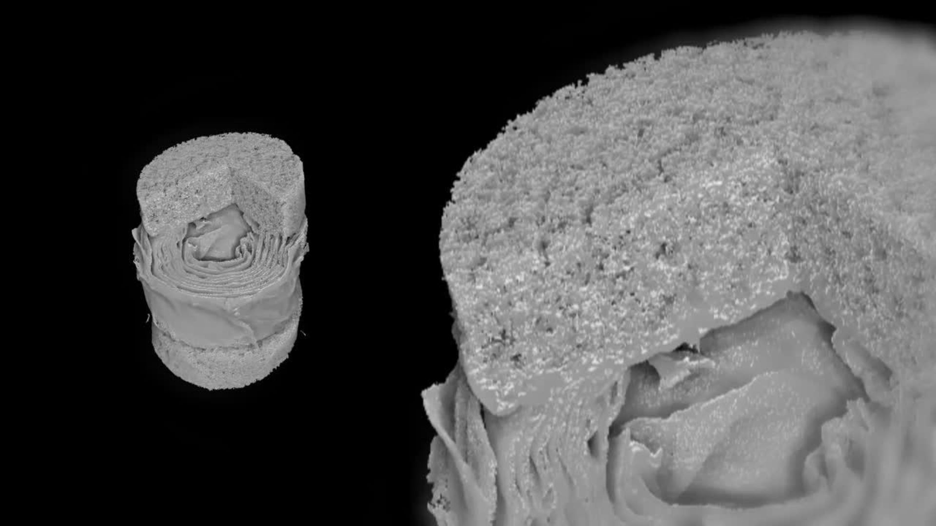 Watch Dischi intervertebrali ricostruiti in laboratorio: un video ci ...