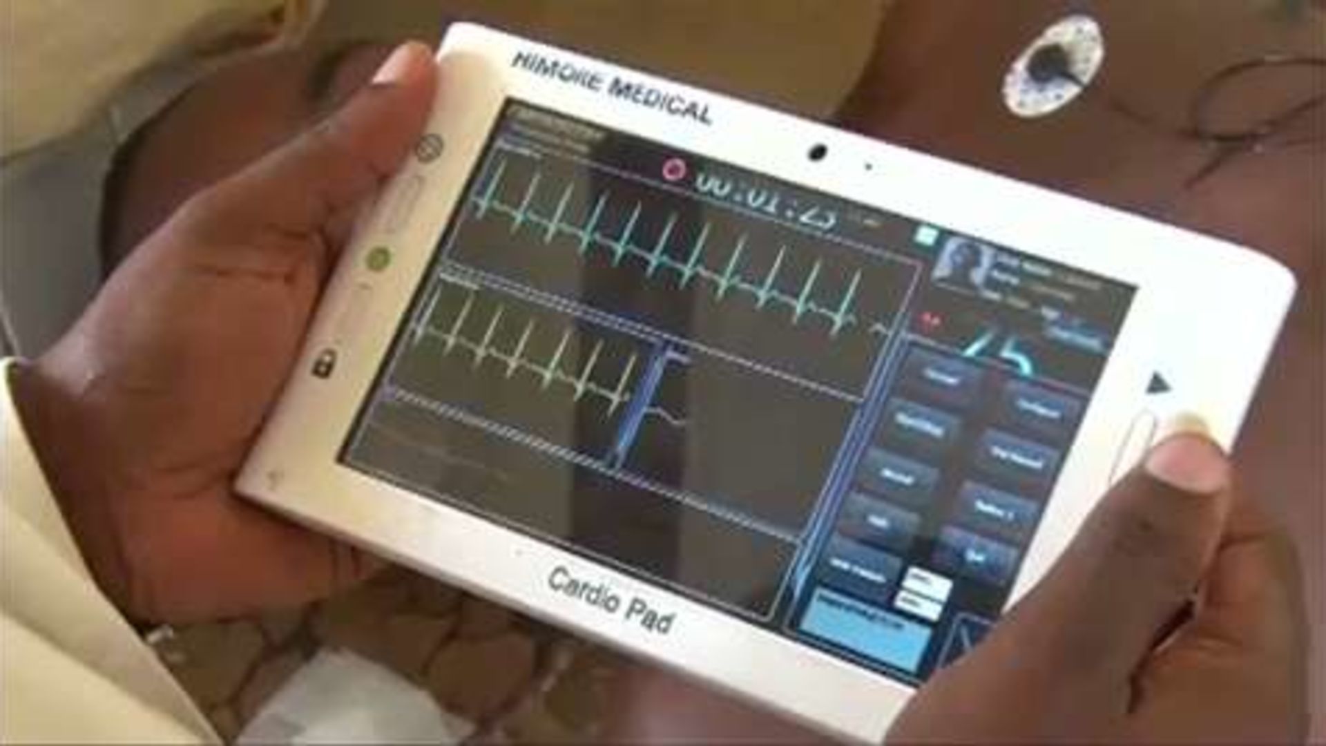 Watch Cardiopad, il tablet per il controllo cardiaco in remoto | Wired ...